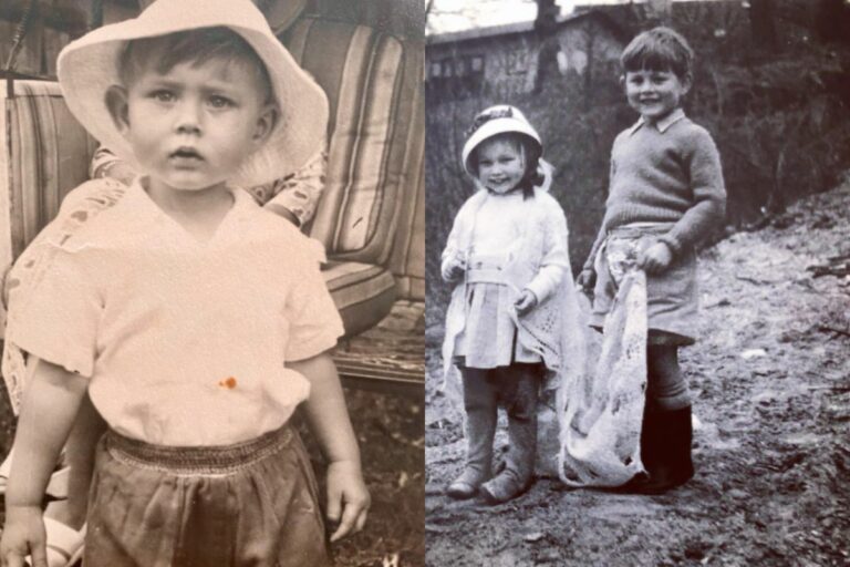 Antes e depois de Ritchie, cantor de 71 anos | DCI